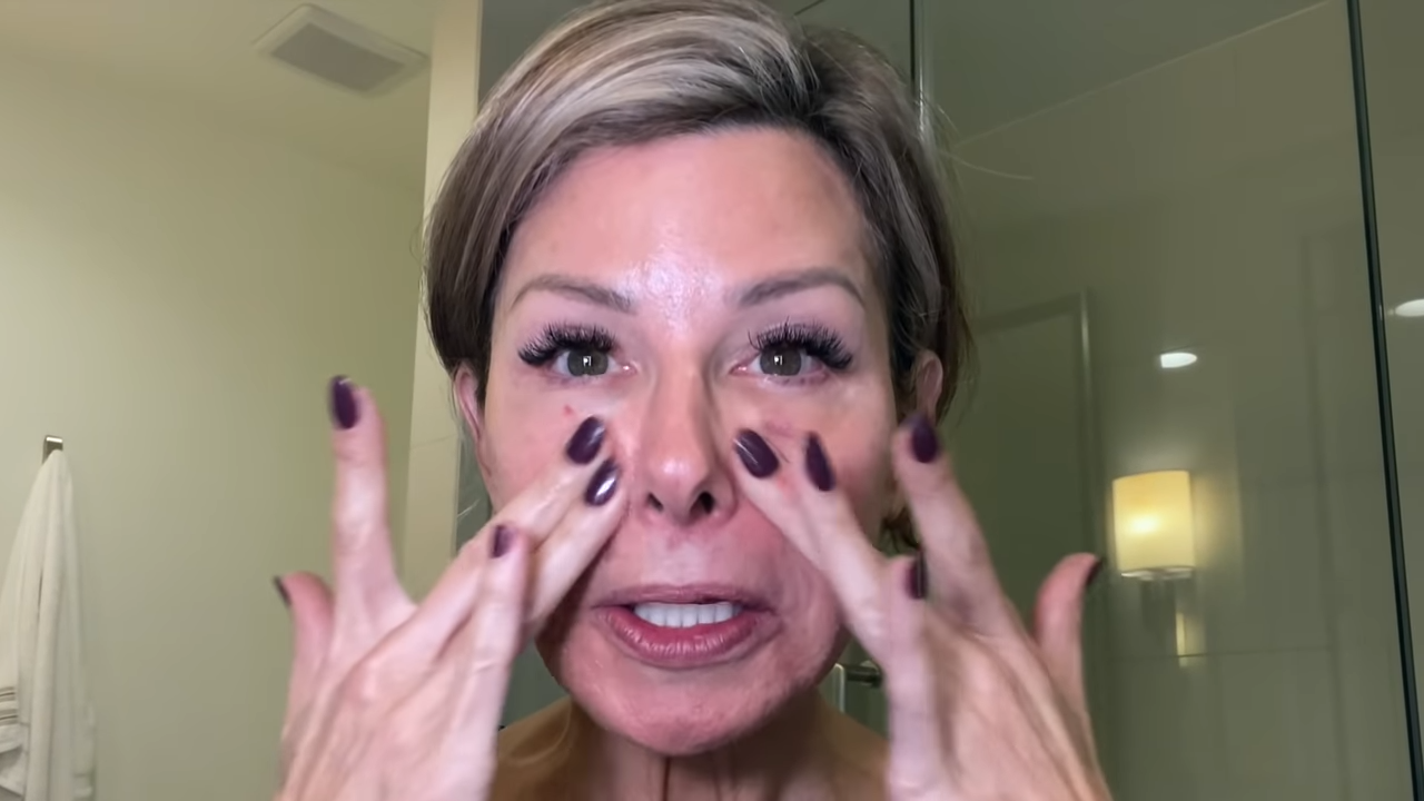 Sculptra: Before & After Results & How it Works (+ Video) - Dominique ...